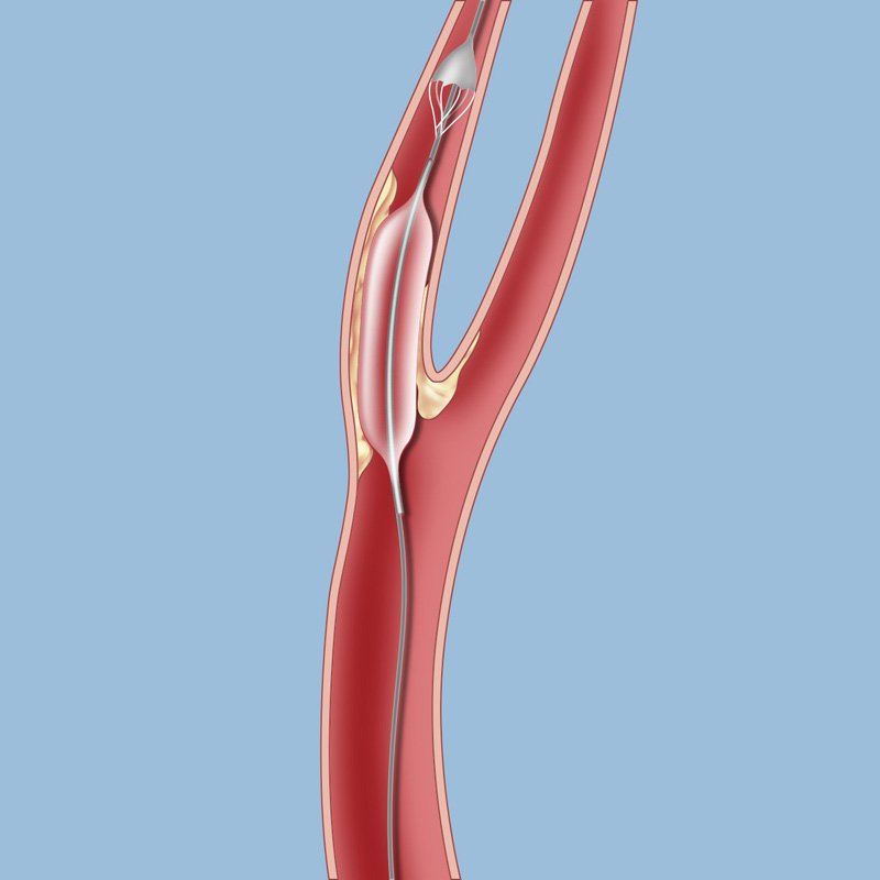INTERVENTIONAL RADIOLOGY - Oncomd